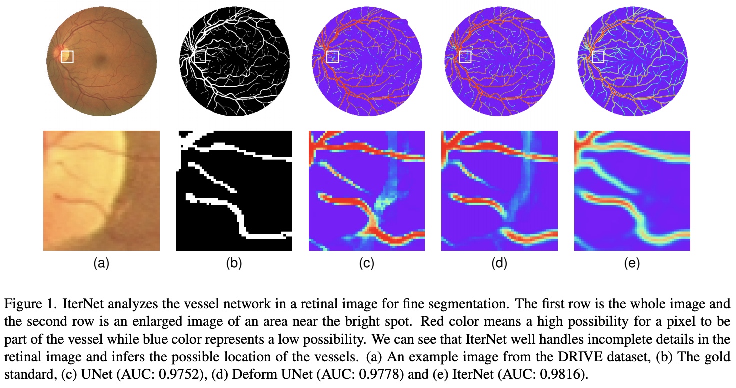 Iternet Retinal Image Segmentation Utilizing Structural Redundancy In